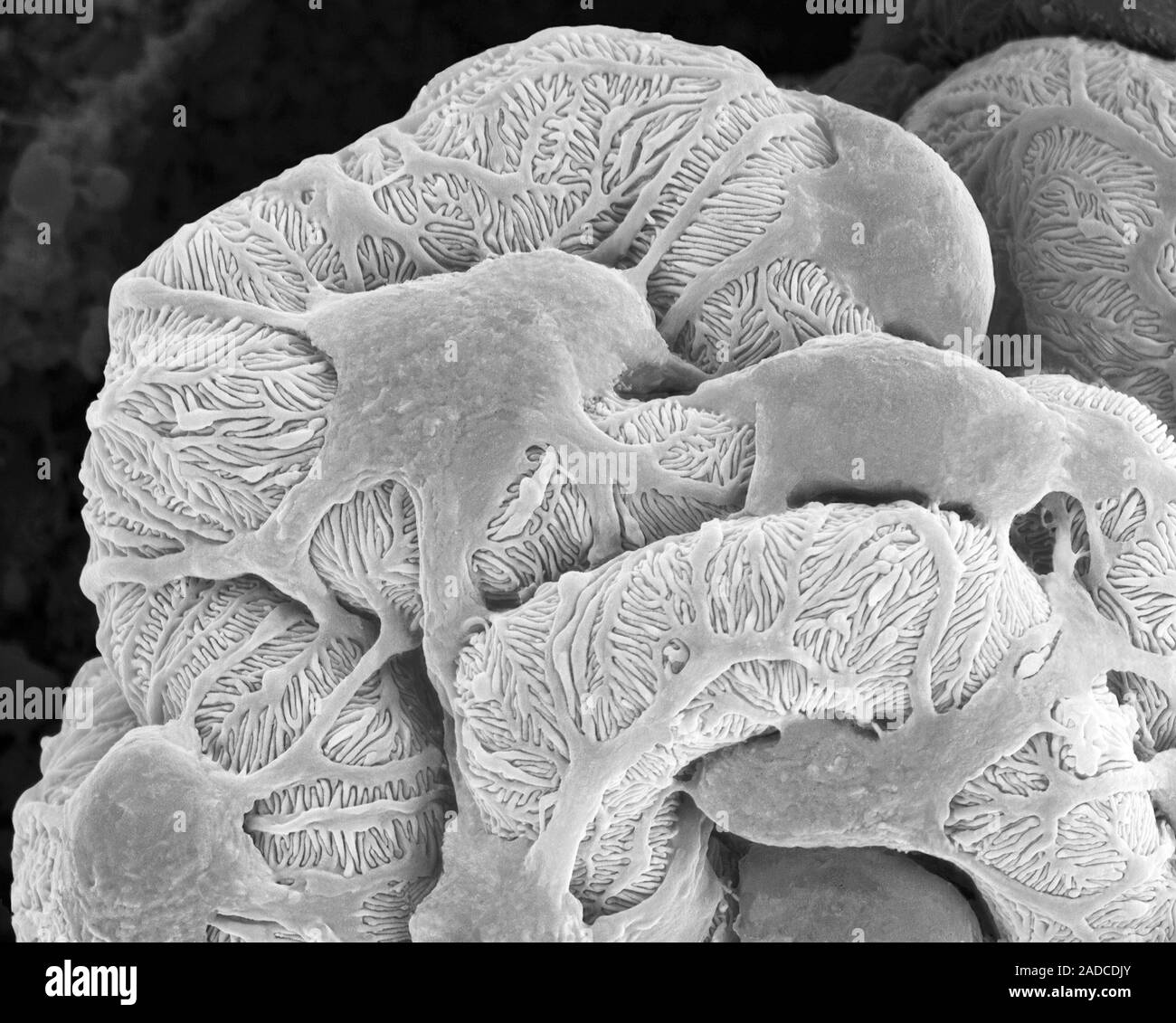 Modelo De Corpúsculo Renal