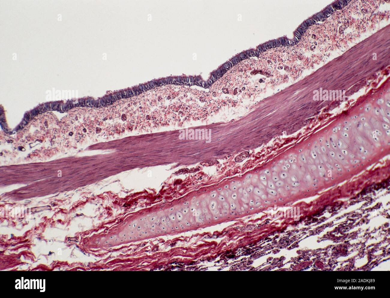 Celulas Caliciformes Segunda Parte - vrogue.co