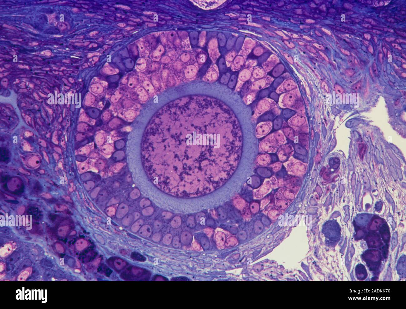 Folículo Primordial