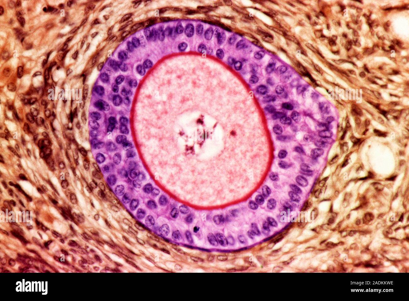 Folículo Primordial