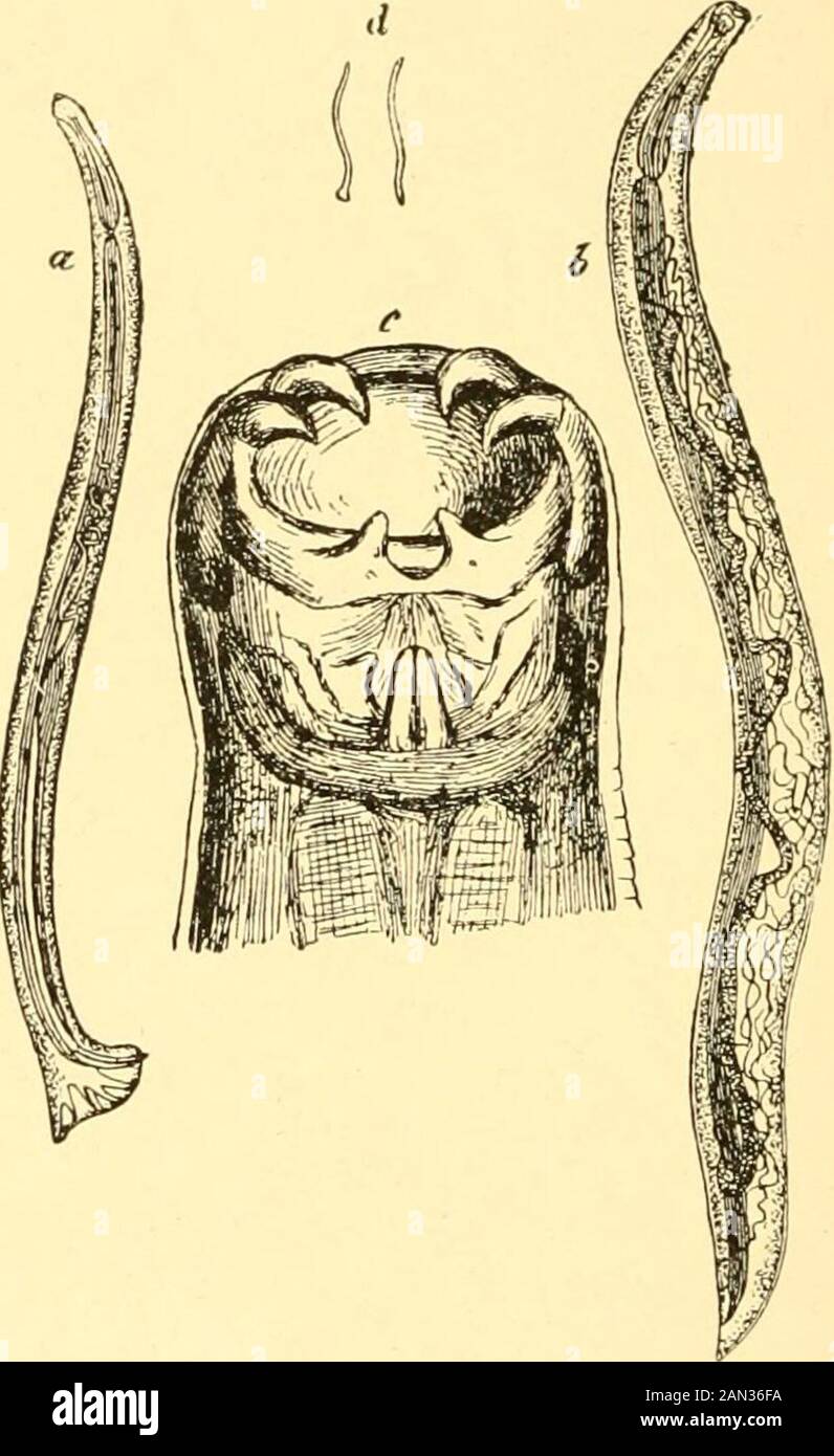 Uncinariasis O Anquilostomiasis Informacin Prctica
