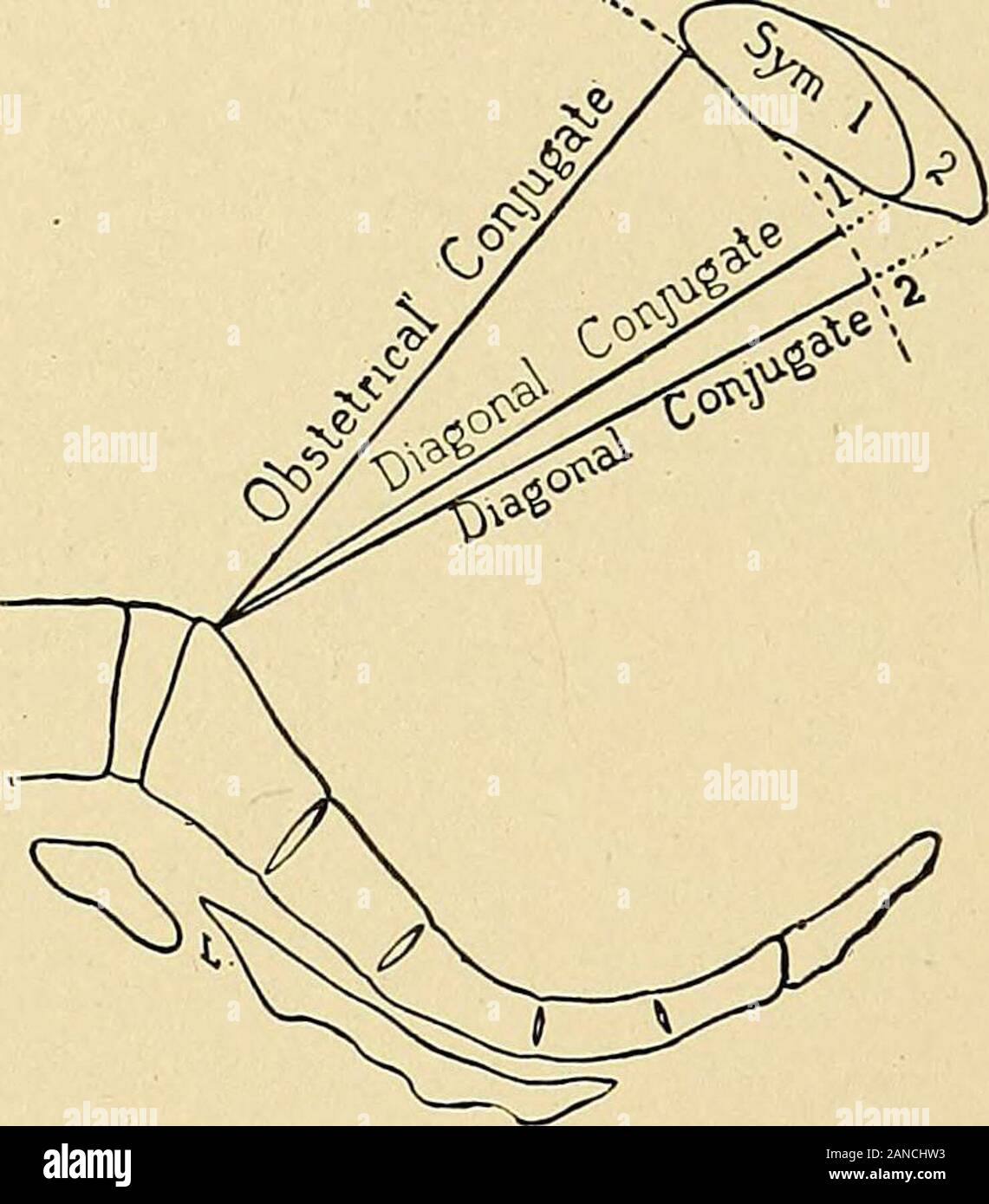 Conjugado Obstétrico