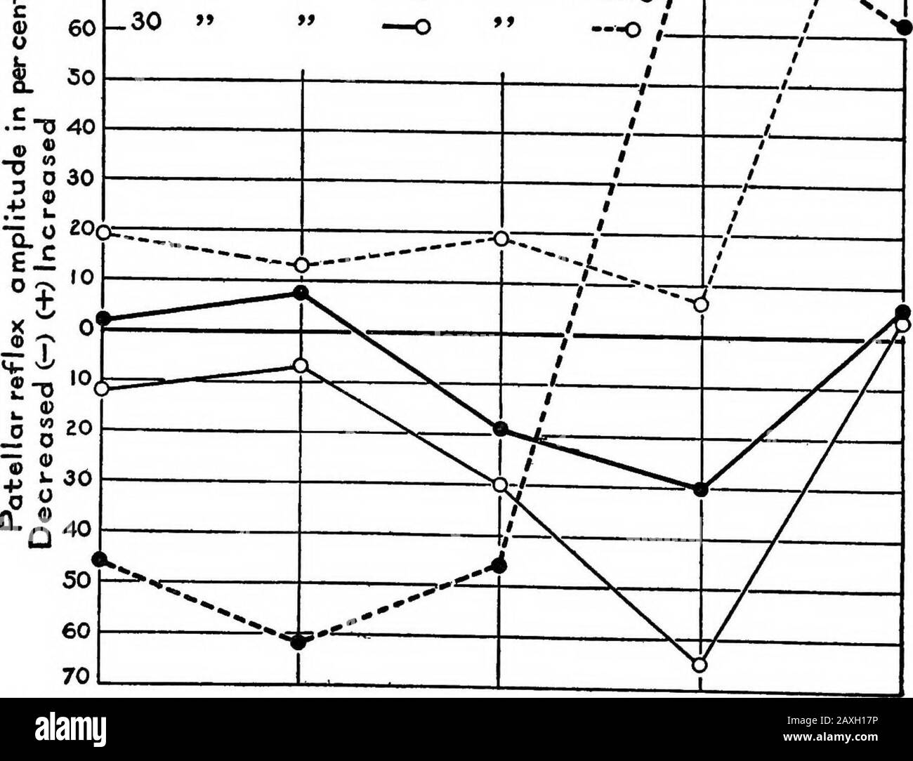 Diagrama De Reflejo Rotuliano