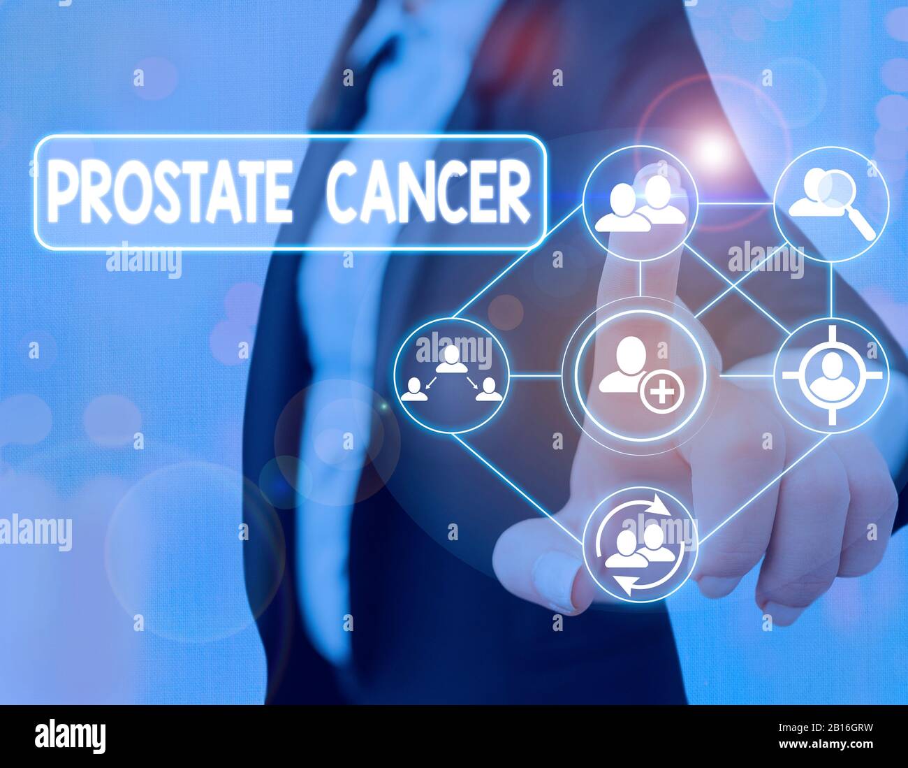 Signo De Texto Que Muestra El Cáncer De Próstata El Cáncer Del Texto