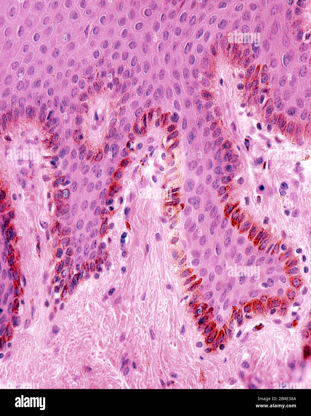 Histología Del Estrato Basal