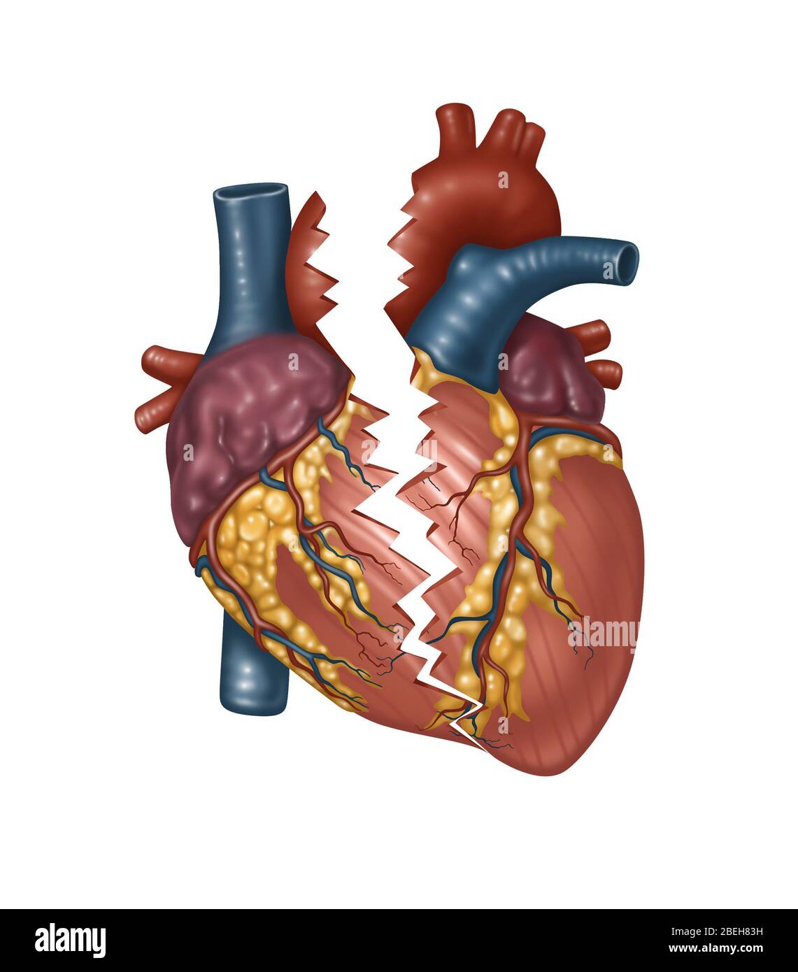 Dibujos De Corazones Humanos Rotos