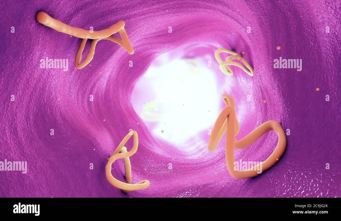 Fotos De Tenias En Humanos