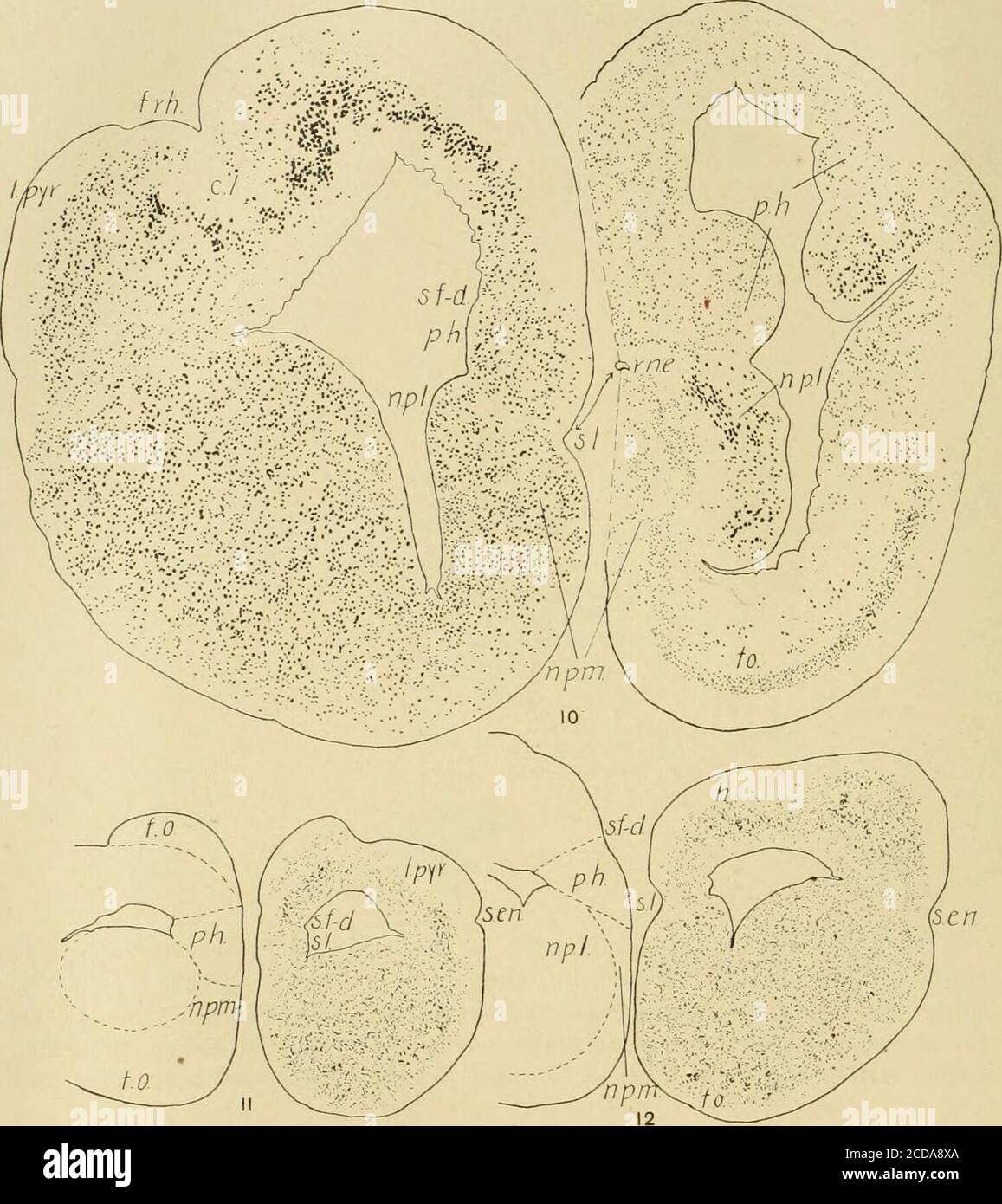 Diagrama De Disección De Cerebro De Rata