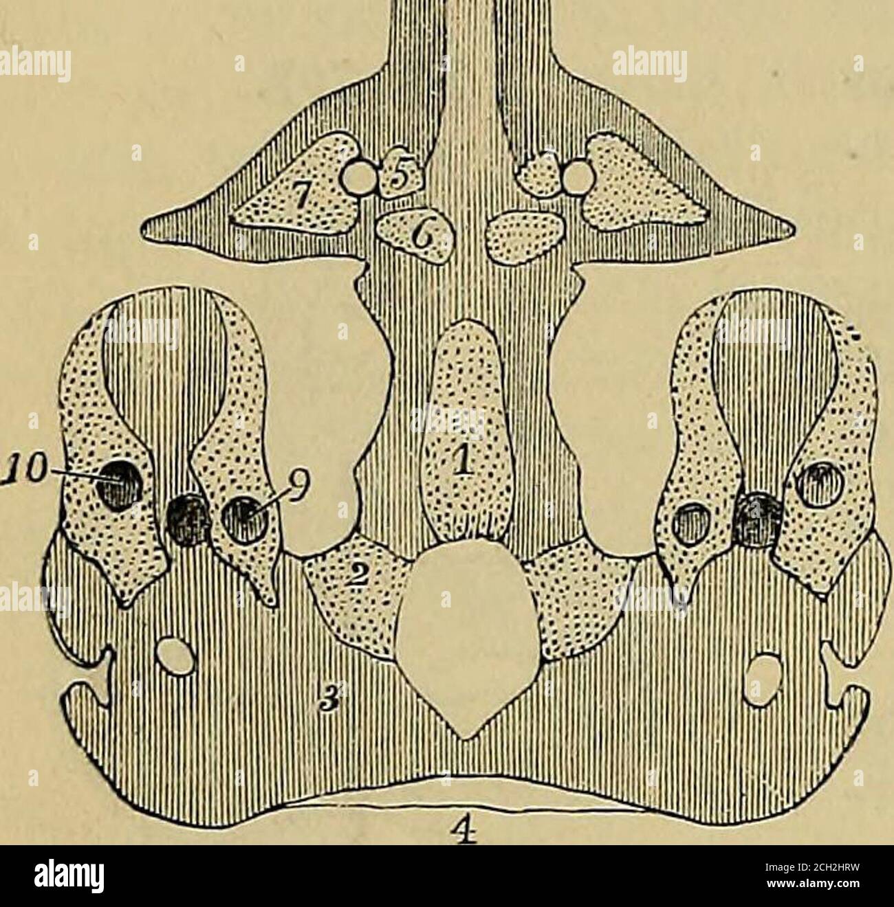 Infundíbulo De La Nariz