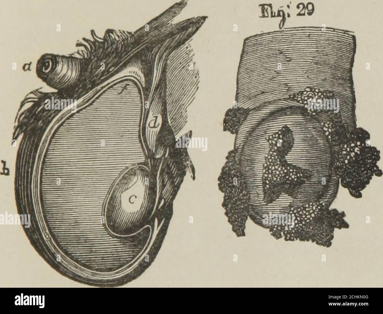 Enfermedades En El Escroto Imagen