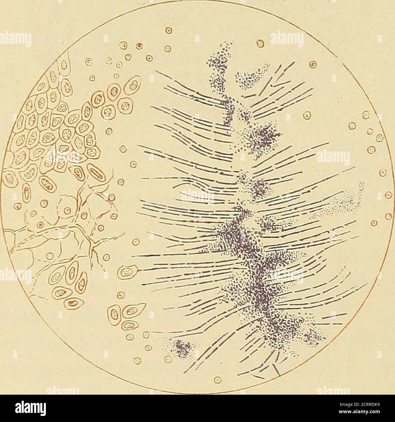 Leptothrix Como Se Pega - BRAINCP