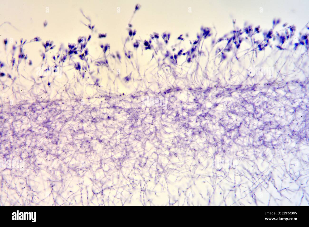 Microscopio Ascomicota