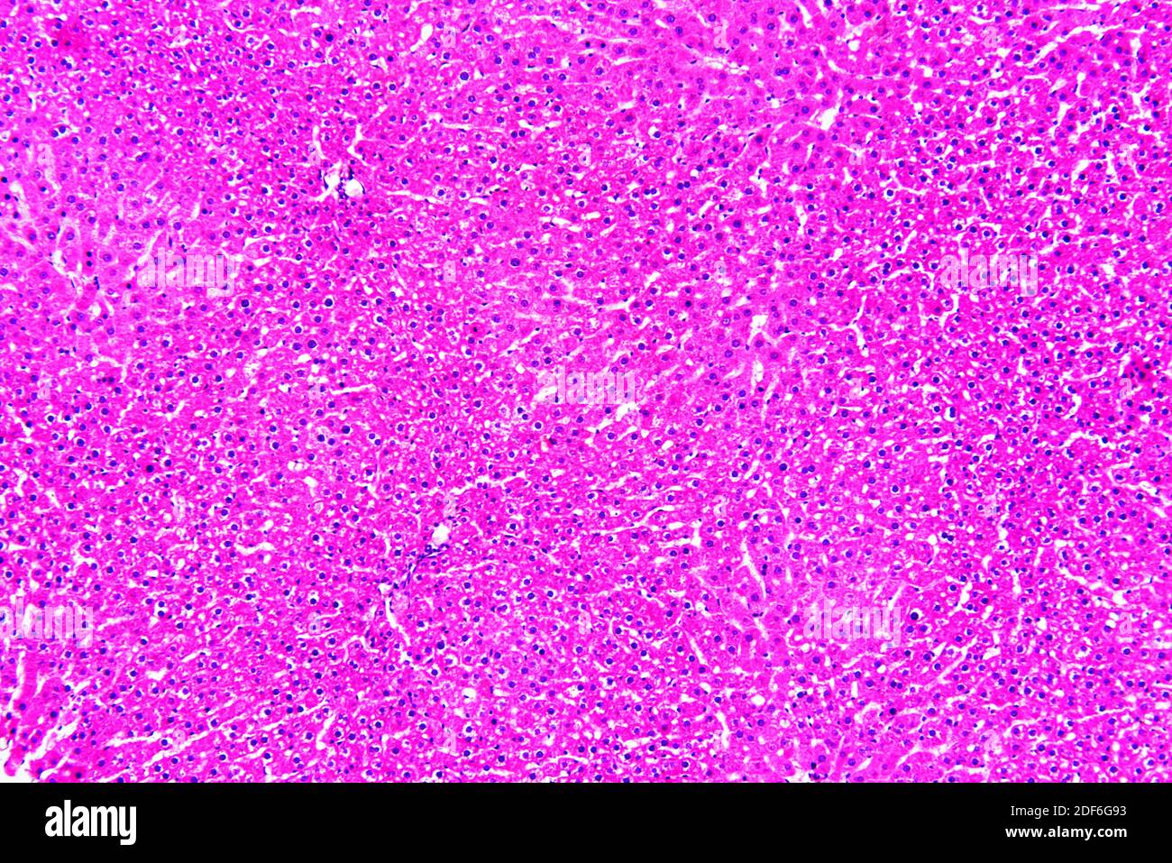 Hepatocitos Normales