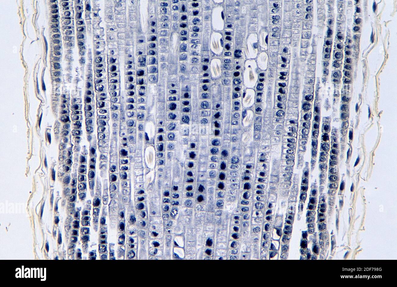 Meristema Apical De La Raíz