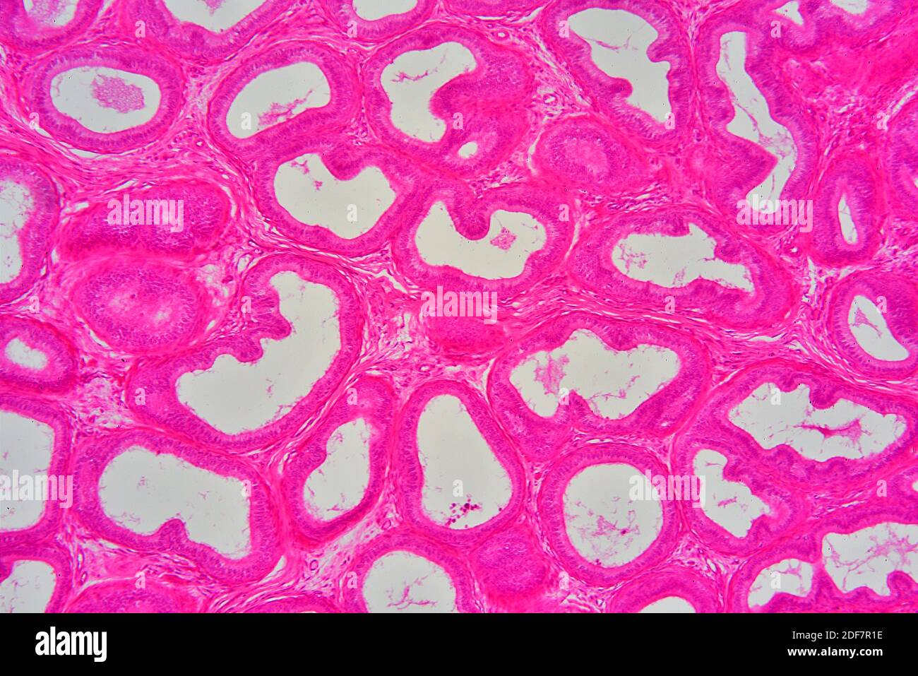 Diagrama De Cisto Epididimal Histología Del Aparato Reproductor