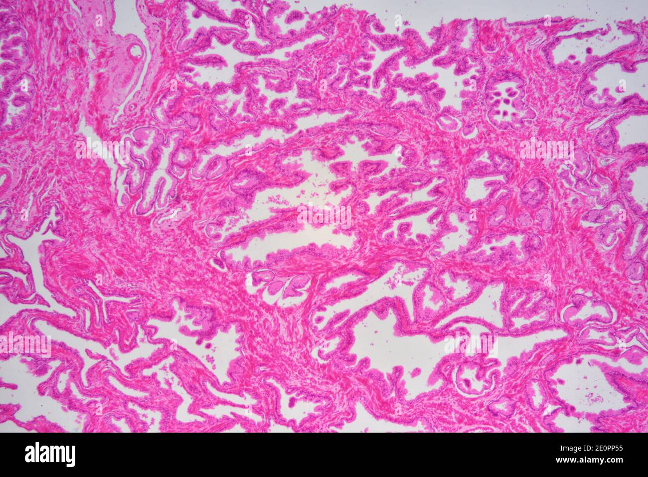 Tejido Conectivo Epitelial Fotos e Imágenes de stock - Alamy