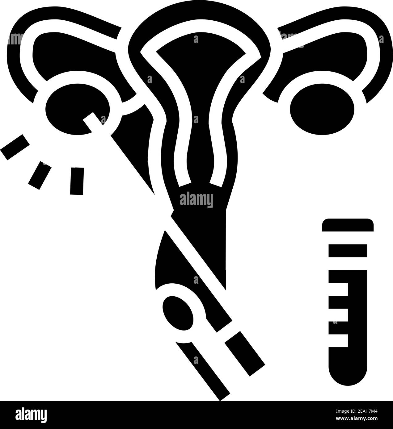 Transferencia De Embrión Imágenes Vectoriales De Stock Alamy
