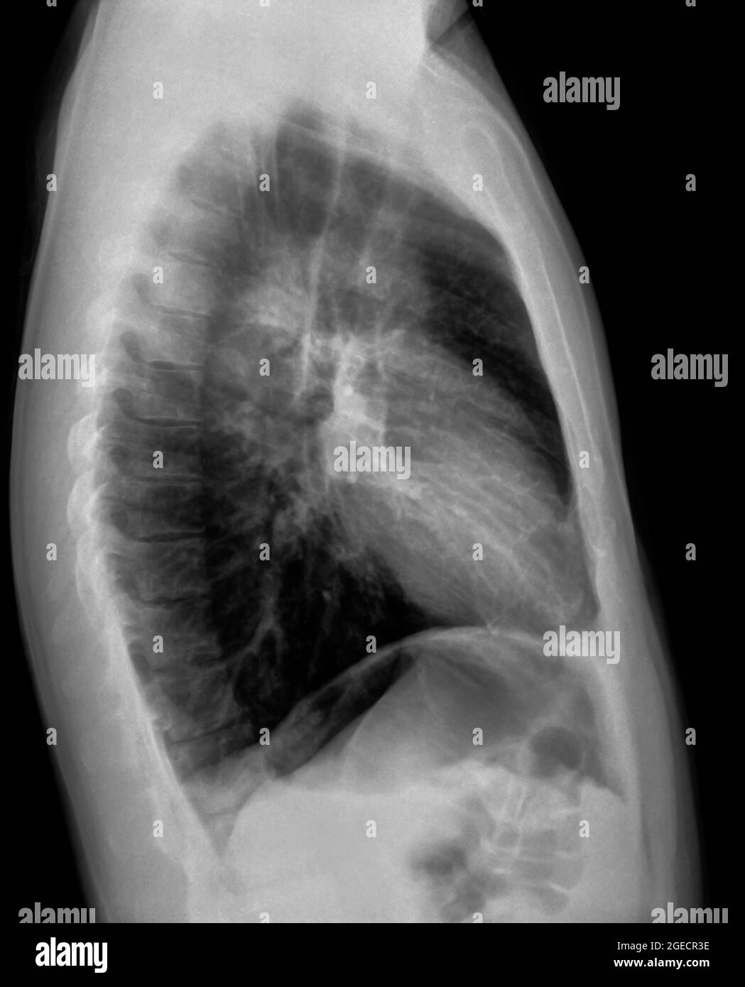 Pecho Humano Anatomia Imágenes De Stock En Blanco Y Negro Alamy