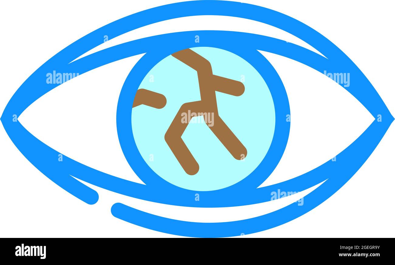 Lesión Del Cristalino Oftalmología Icono De Color Ilustración Vectorial
