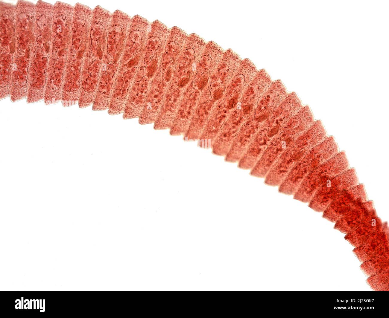 Fotos De Tenias En Humanos