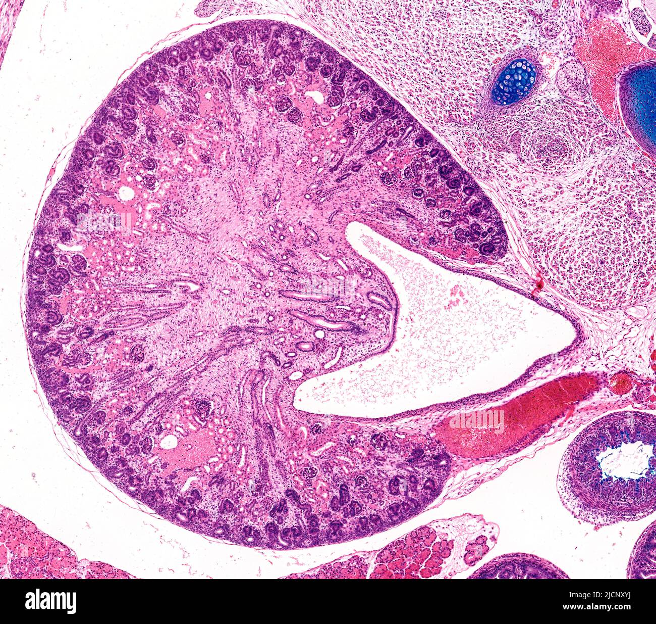Histología De La Pirámide Renal