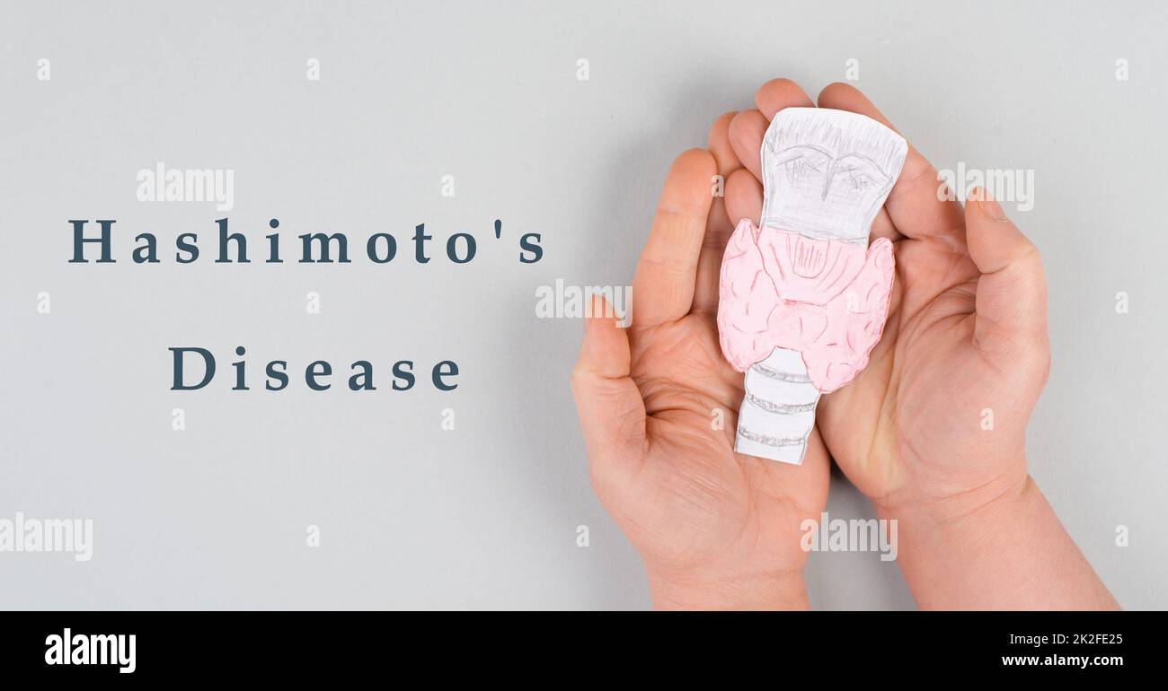 Tiroiditis De Hashimoto Enfermedad Linfocítica Crónica Sosteniendo Un