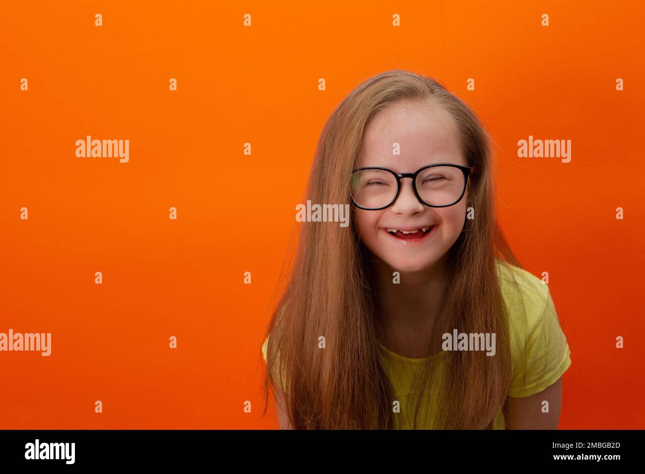 Chica Feliz Con Síndrome De Down Divirtiéndose Riendo Coletas