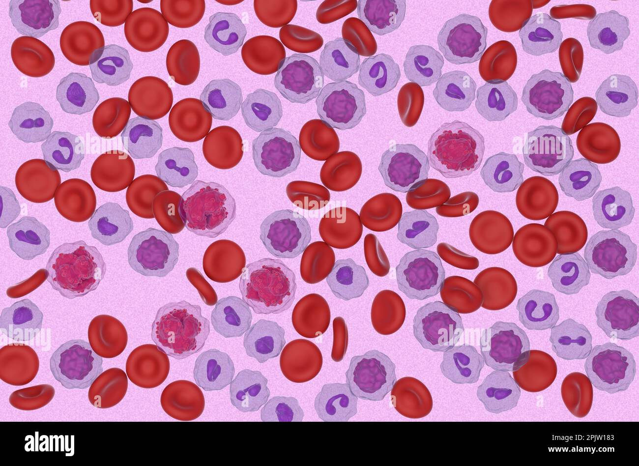 Leucemia Al Microscopio