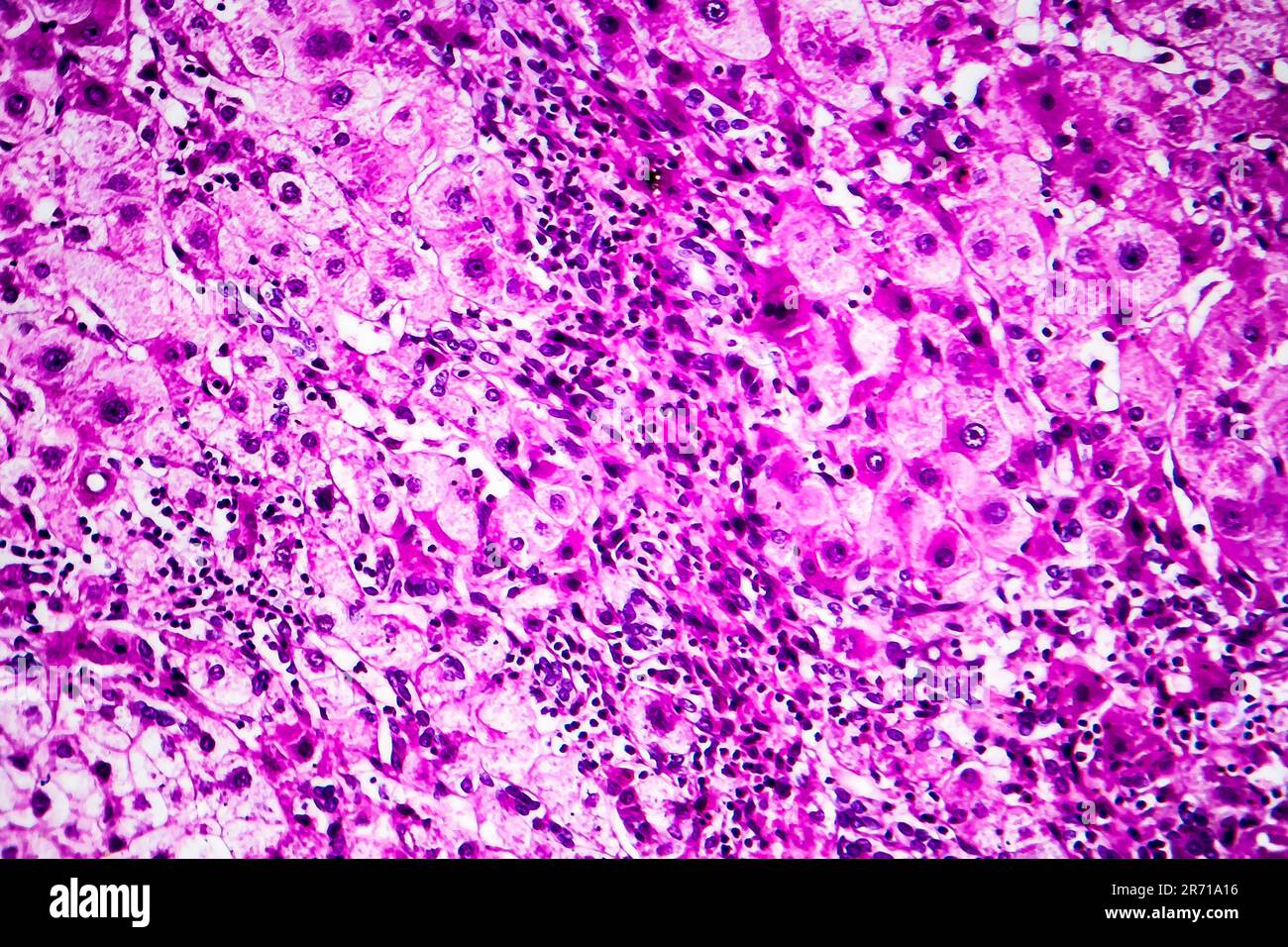Histologia Da Arteria Hepatica Sintomas Cirrose Hepatica Fase Terminal