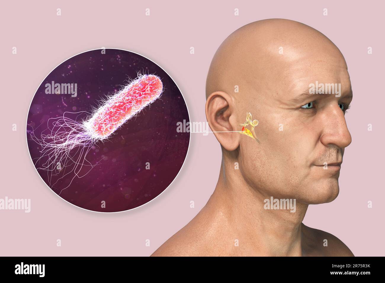 Bacteria pseudomonas aeruginosa fotografías e imágenes de alta ...