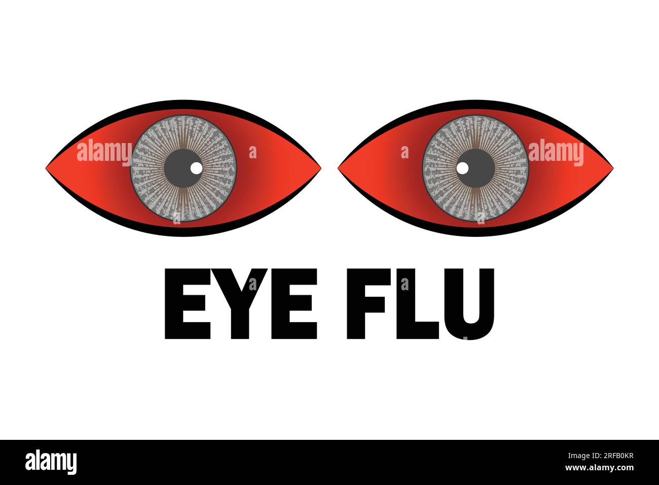 El Virus De La Conjuntivitis Afectó El Ojo Rojo Concepto De Infección