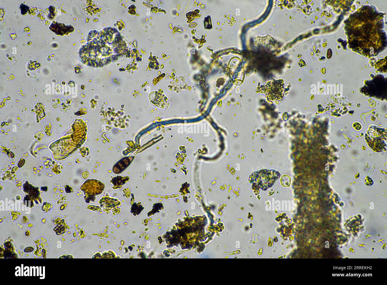 vida del suelo bajo el microscopio con hongos del suelo e hifas ...