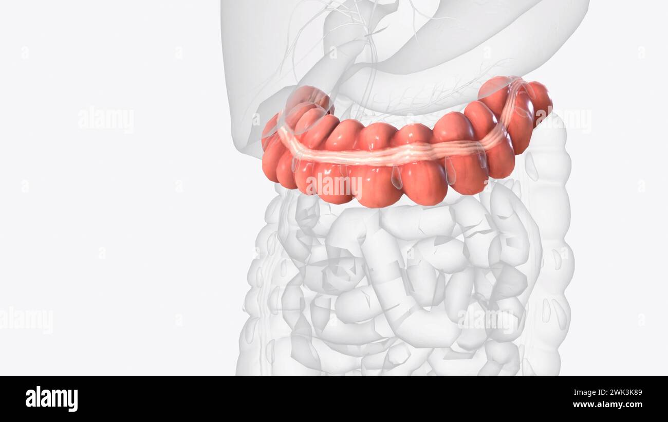 Transverse colon fotografías e imágenes de alta resolución - Alamy