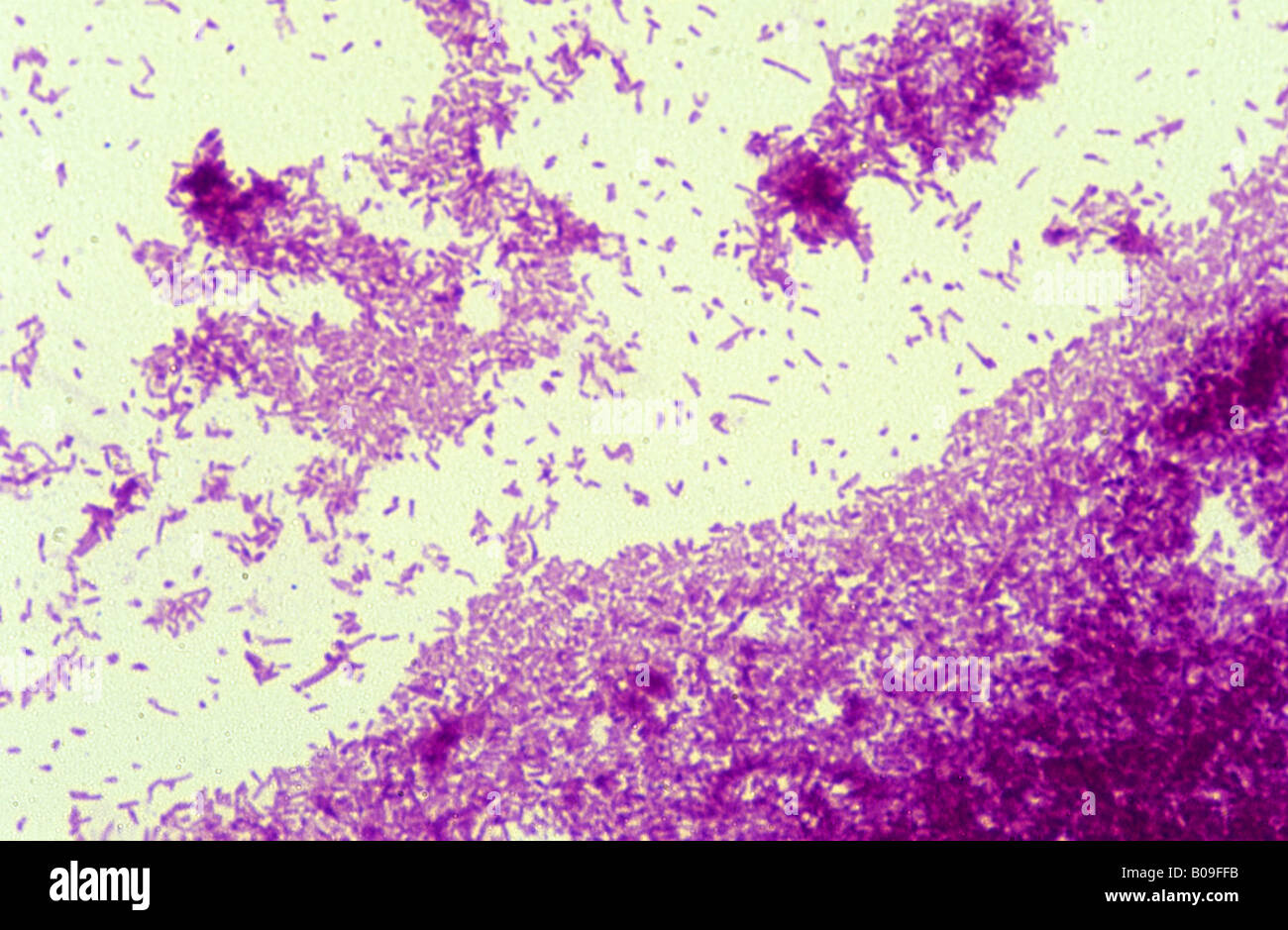 Mycobacterium Tuberculosis Microscope Fotografías E Imágenes De Alta