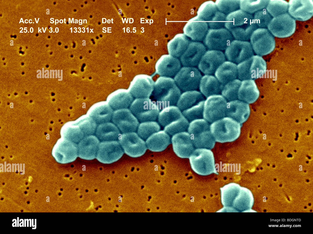Bacteria Acinetobacter Baumannii Fotos e Imágenes de stock - Alamy