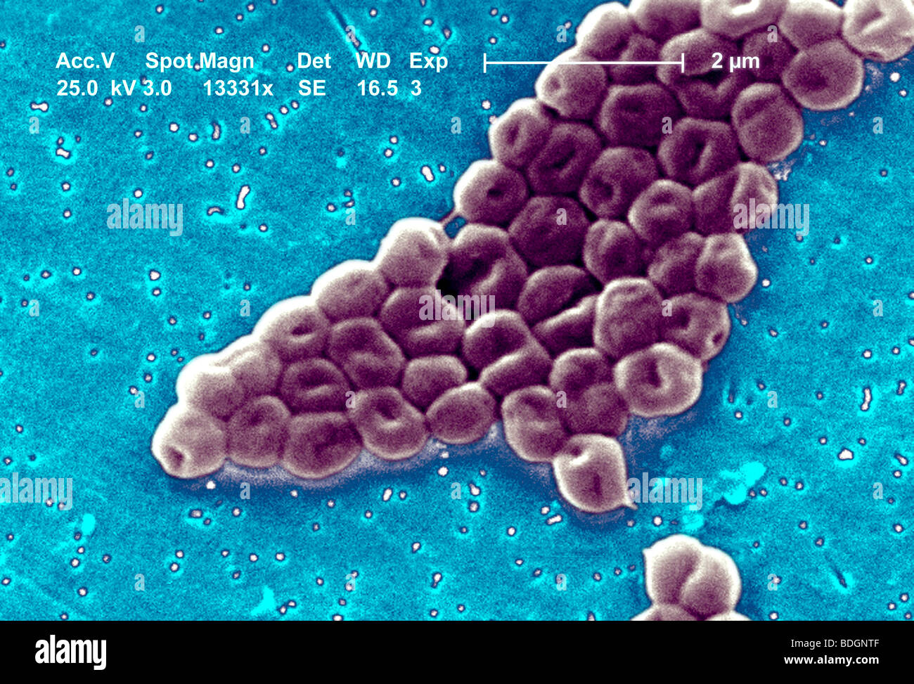 Bacteria Acinetobacter Baumannii Fotos e Imágenes de stock - Alamy