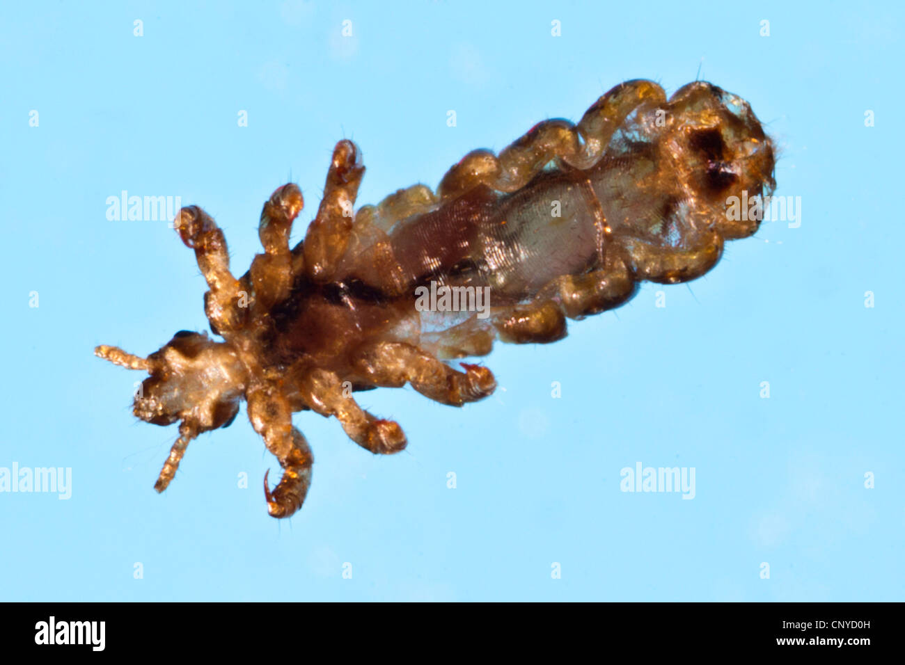 Fotos De Piojos Del Cuerpo