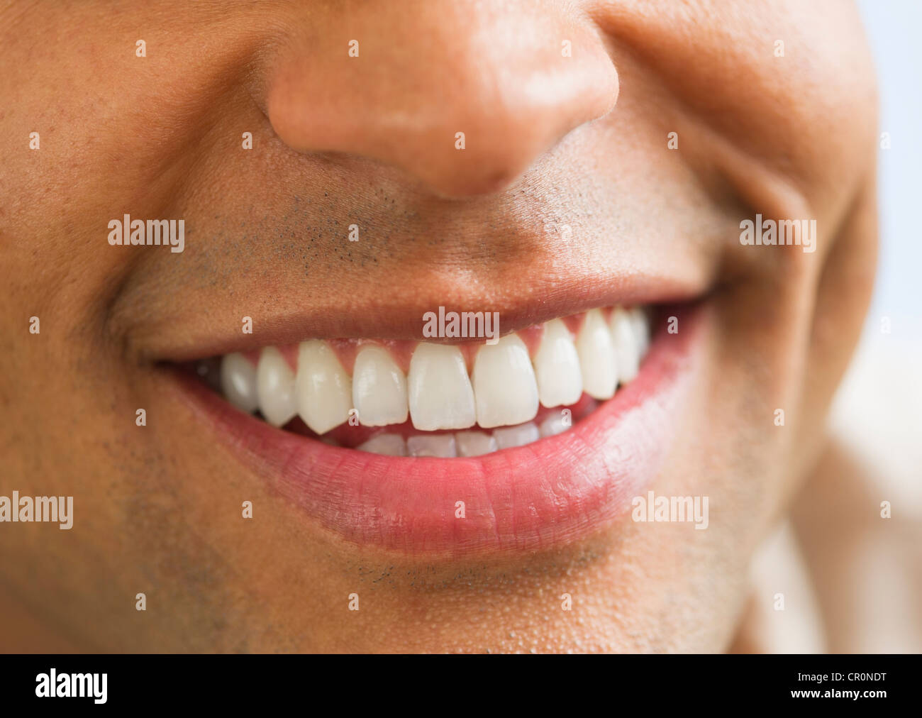 The Features Of A Perfect Smile Orlando Smiles Inc 5 Reasons Pretty ...