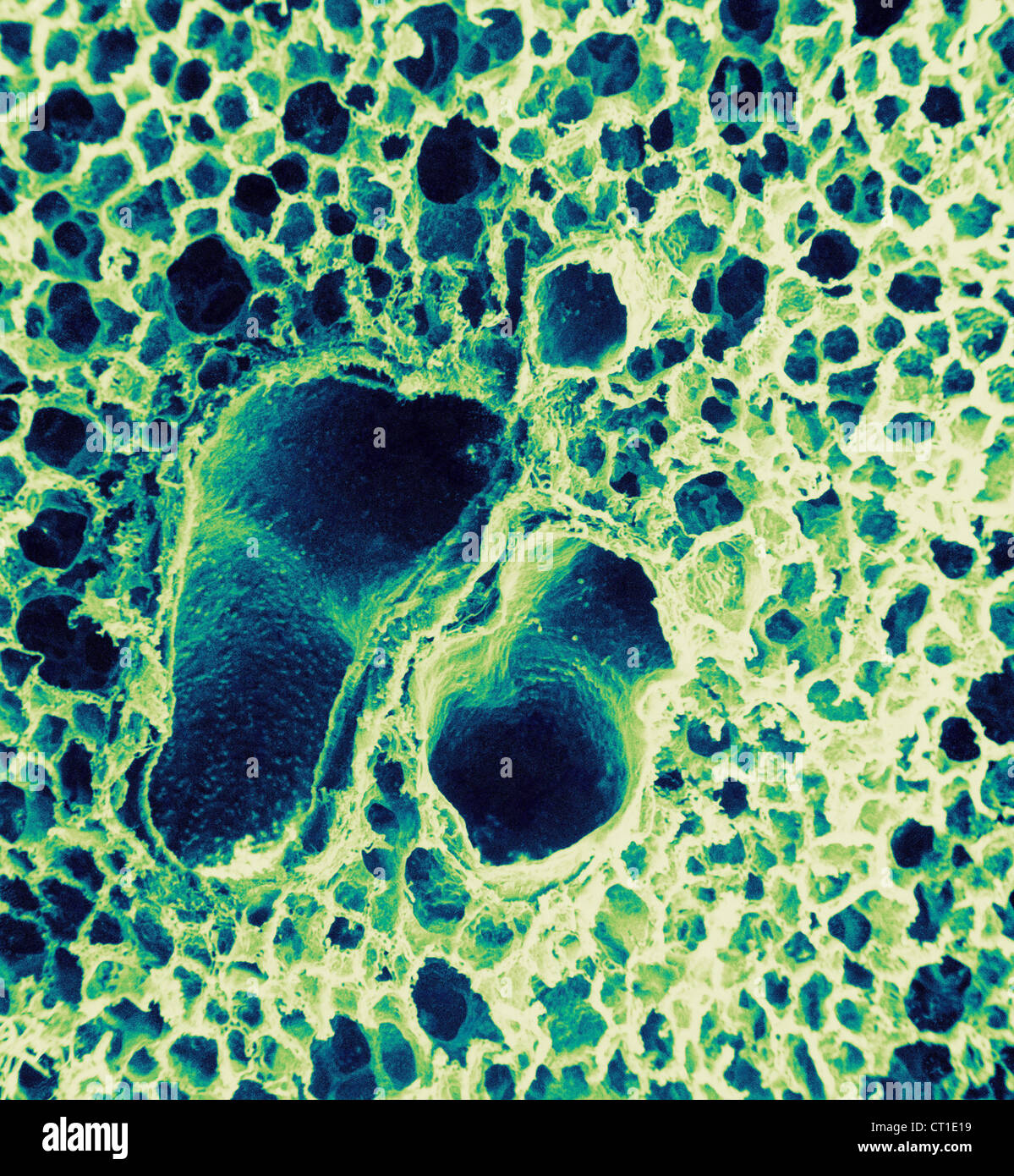 Bronquiolo Respiratorio Microscopio Fotografías E Imágenes De Alta
