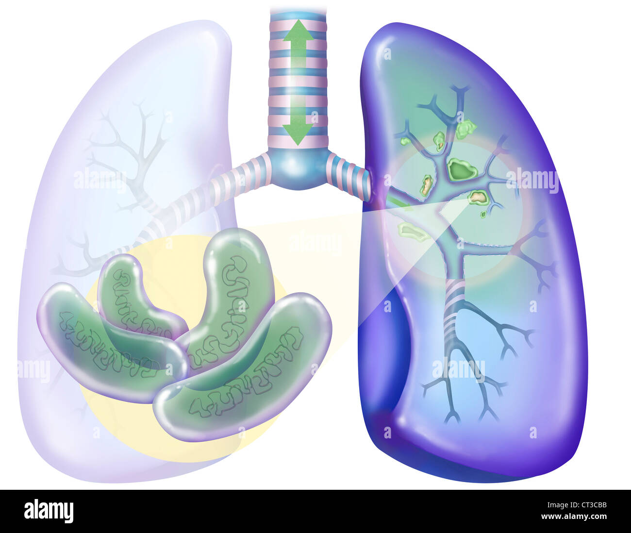 Diagrama De Tuberculos