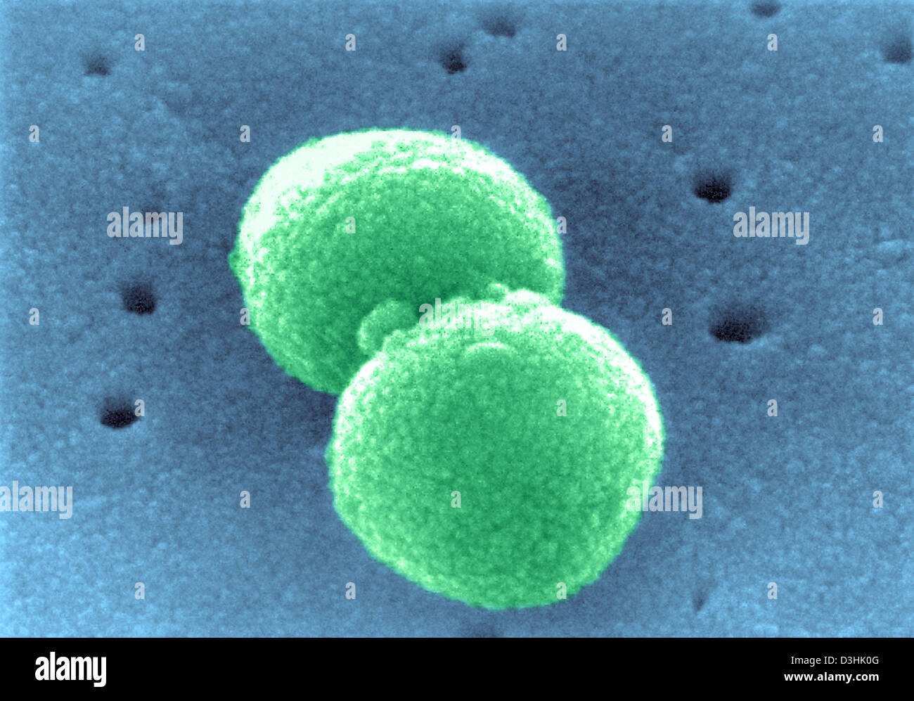 Diplococcus pneumoniae fotografías e imágenes de alta resolución - Alamy