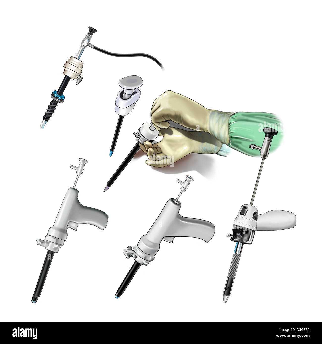 Diferentes Modelos De Instrumentos Laparoscópicos Y Los Trocares