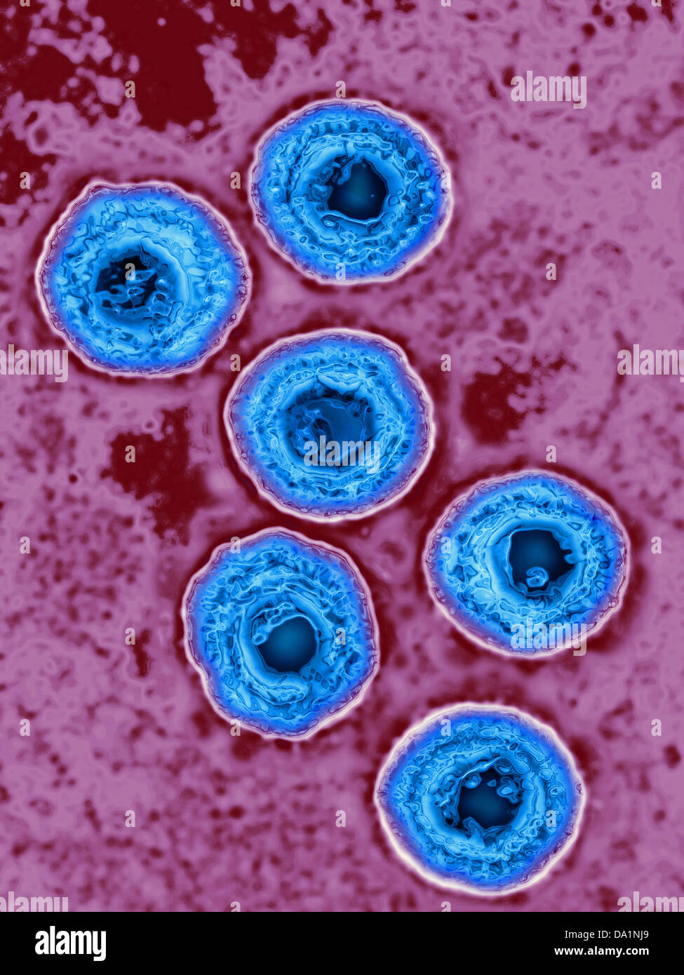 Herpes Genital Fotografías E Imágenes De Alta Resolución Alamy
