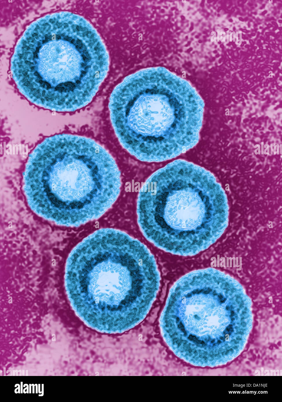 Varicella Zoster Virus Fotos E Imágenes De Stock Alamy