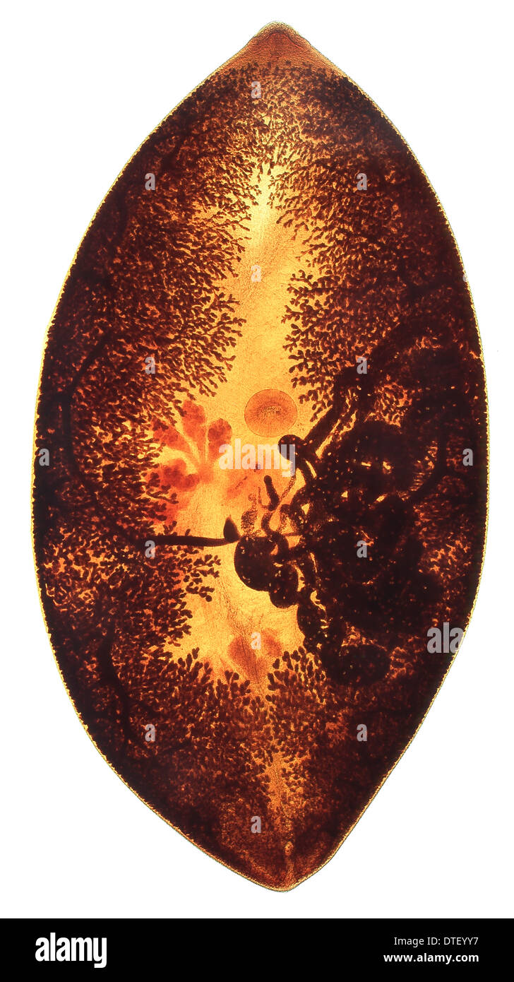 Huevo De Paragonimus Westermani