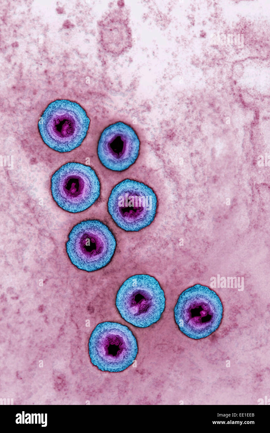 Virus Simplex Fotografías E Imágenes De Alta Resolución Alamy