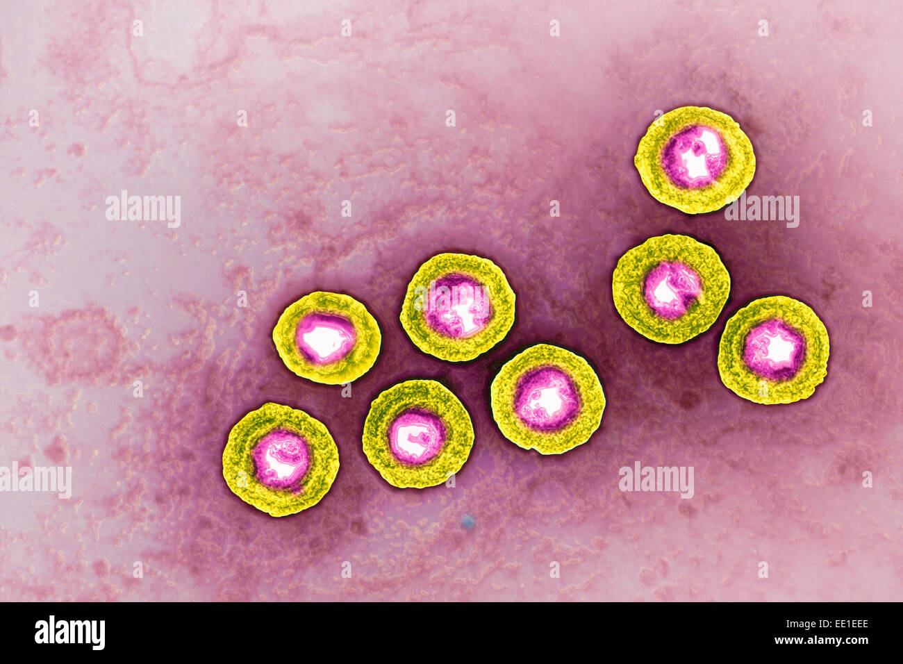 Virus De Herpes Simple Fotografías E Imágenes De Alta Resolución Alamy