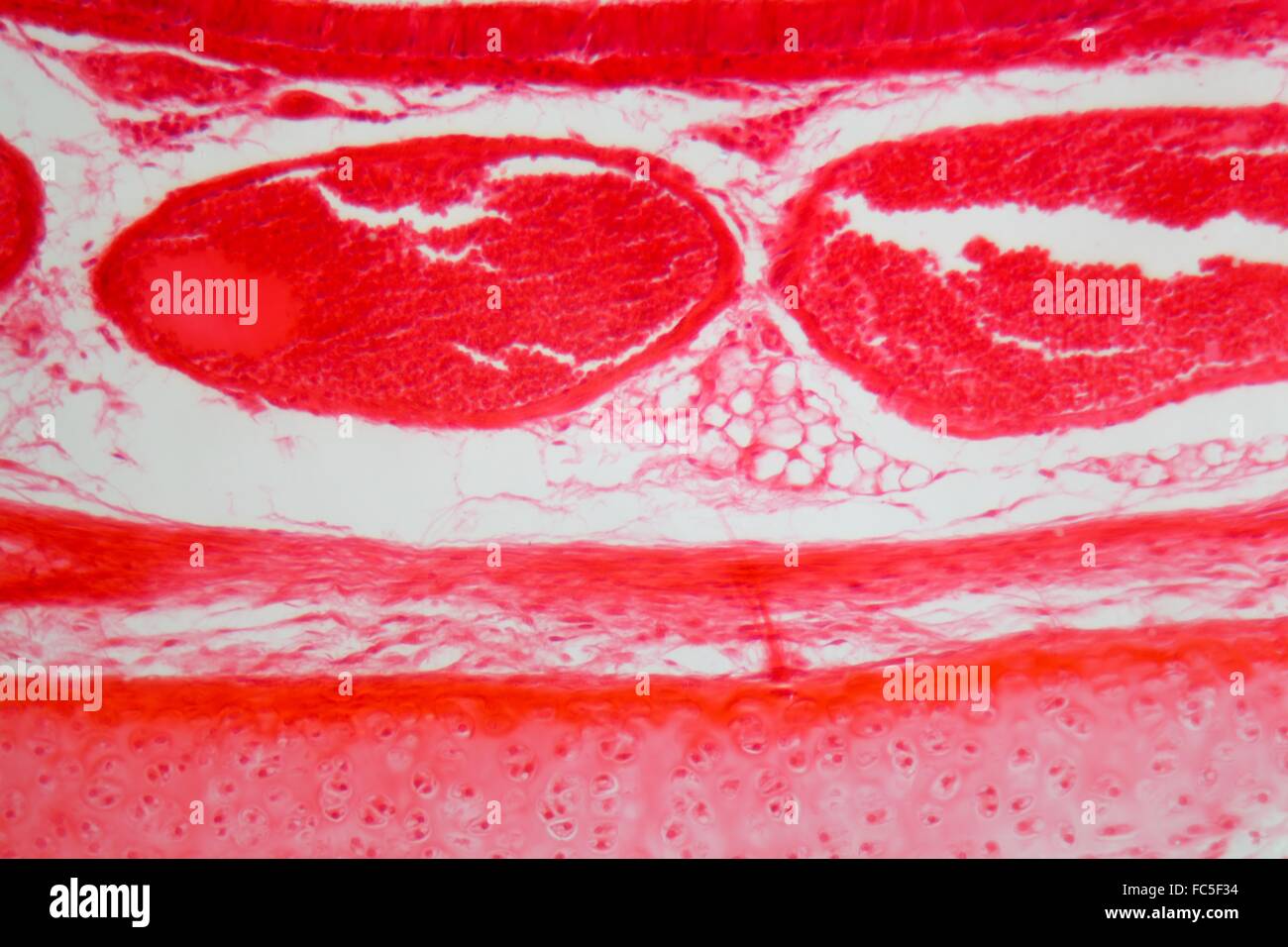 Traqueideos Sob Microscopio