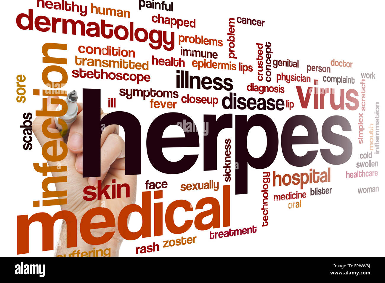 Herpes Zoster Face Fotografías E Imágenes De Alta Resolución Alamy