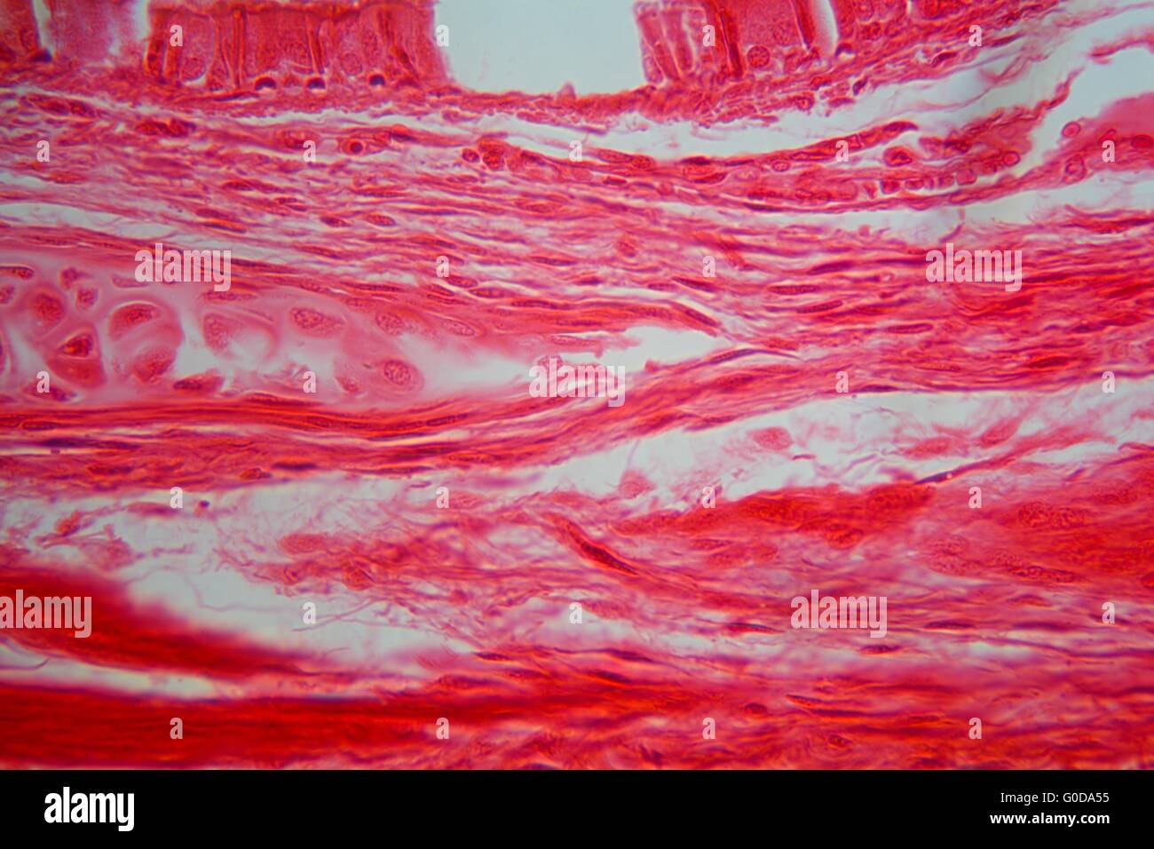 Traqueideos Sob Microscopio